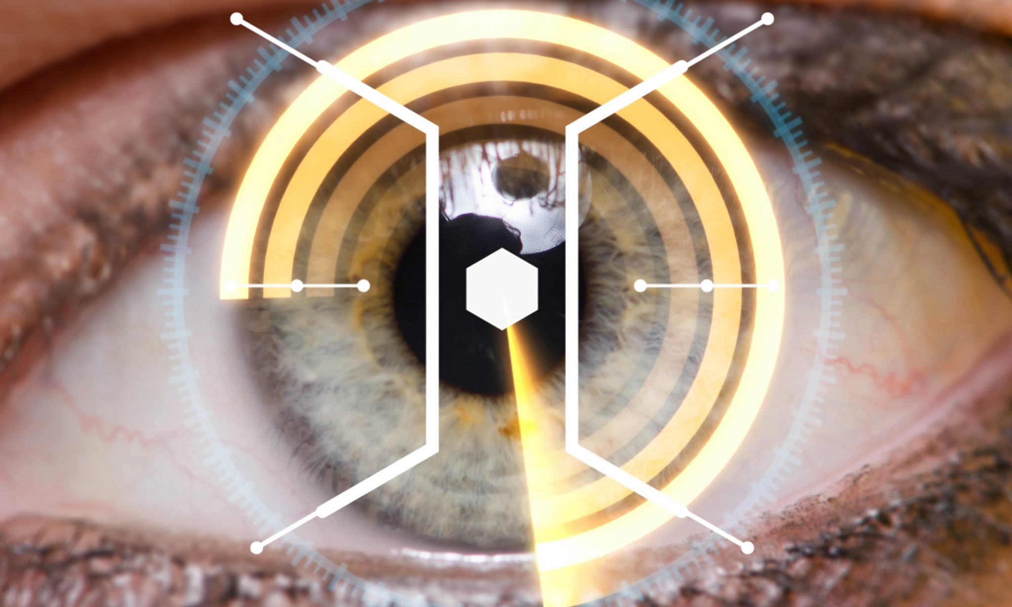 Clear Lens Extractions And How It Can Help You - Alexander Ionides